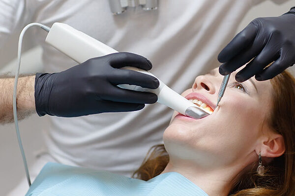 Best Dental Intraoral Scanner - psfdental